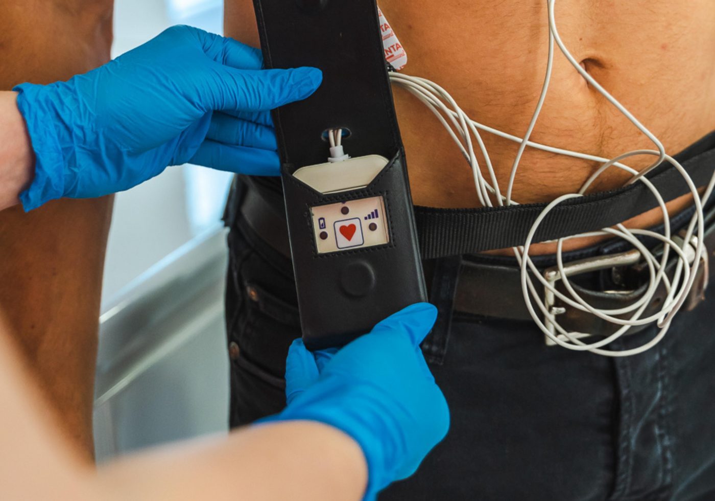 HOLTER EKG Poznań | neoMedica | umów się już dziś!