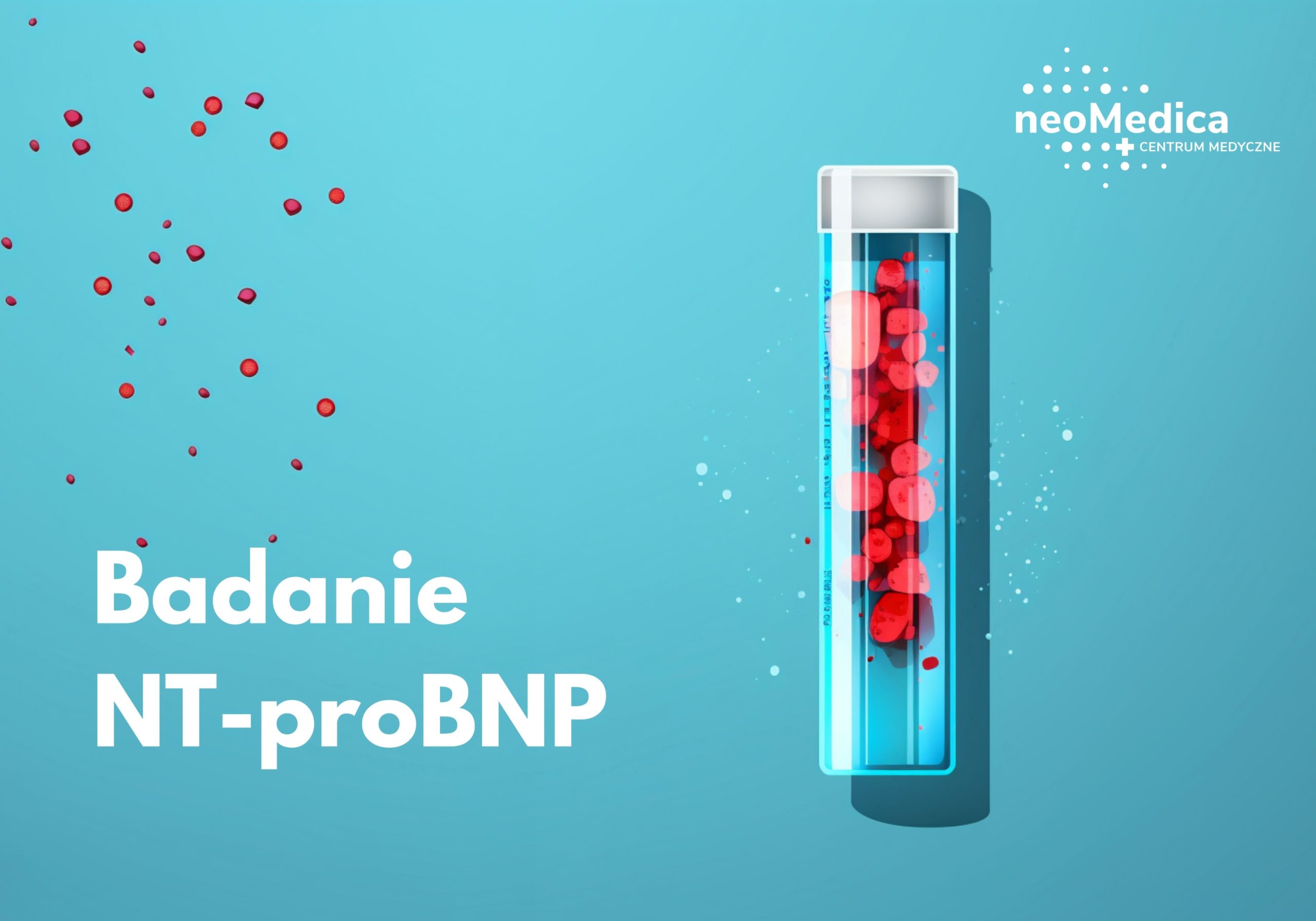 Badanie NT-proBNP Poznań | neoMedica | Kup online ze zniżką