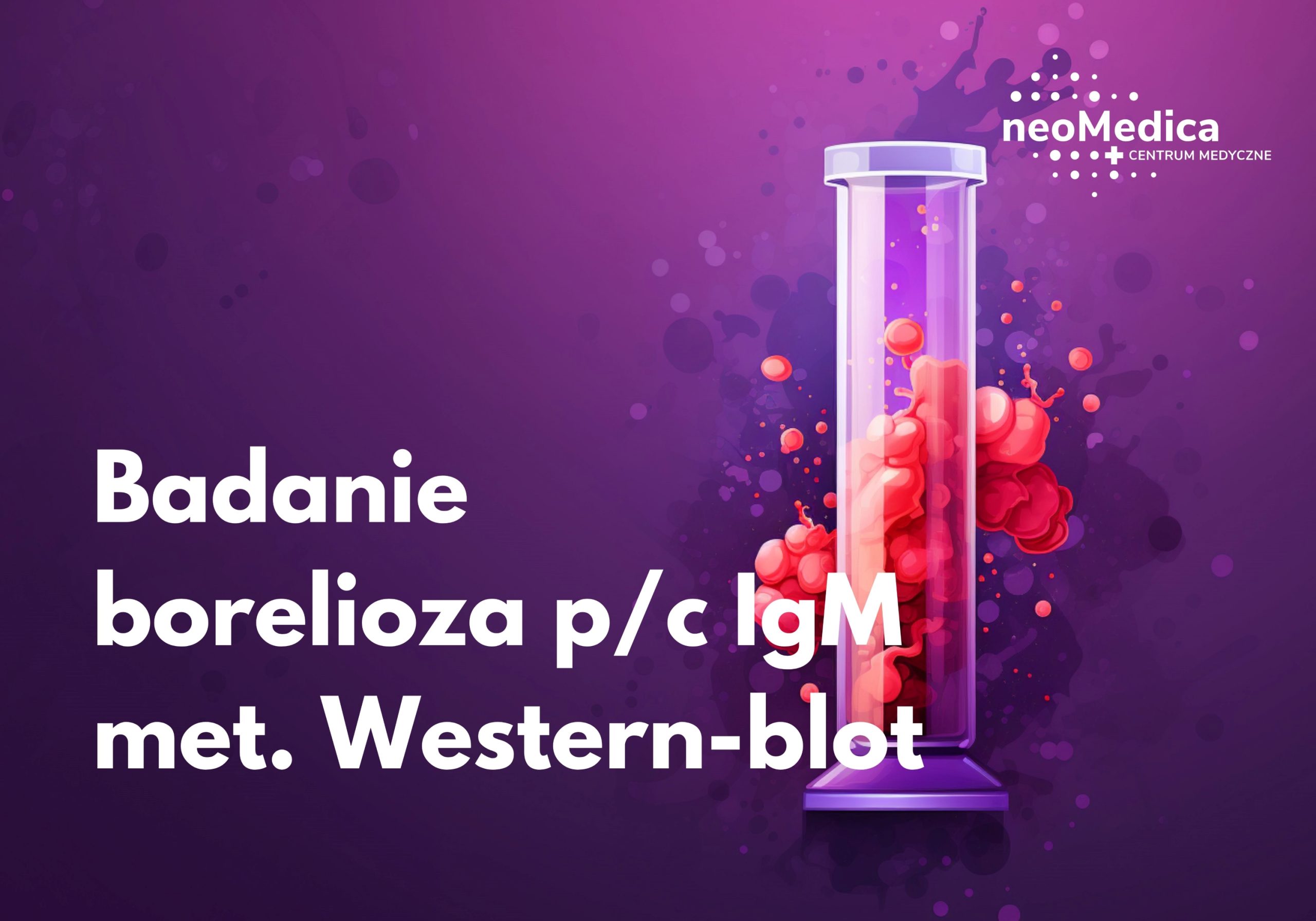 Badanie borelioza p/c IgM met. Western-blot Poznań | neoMedica
