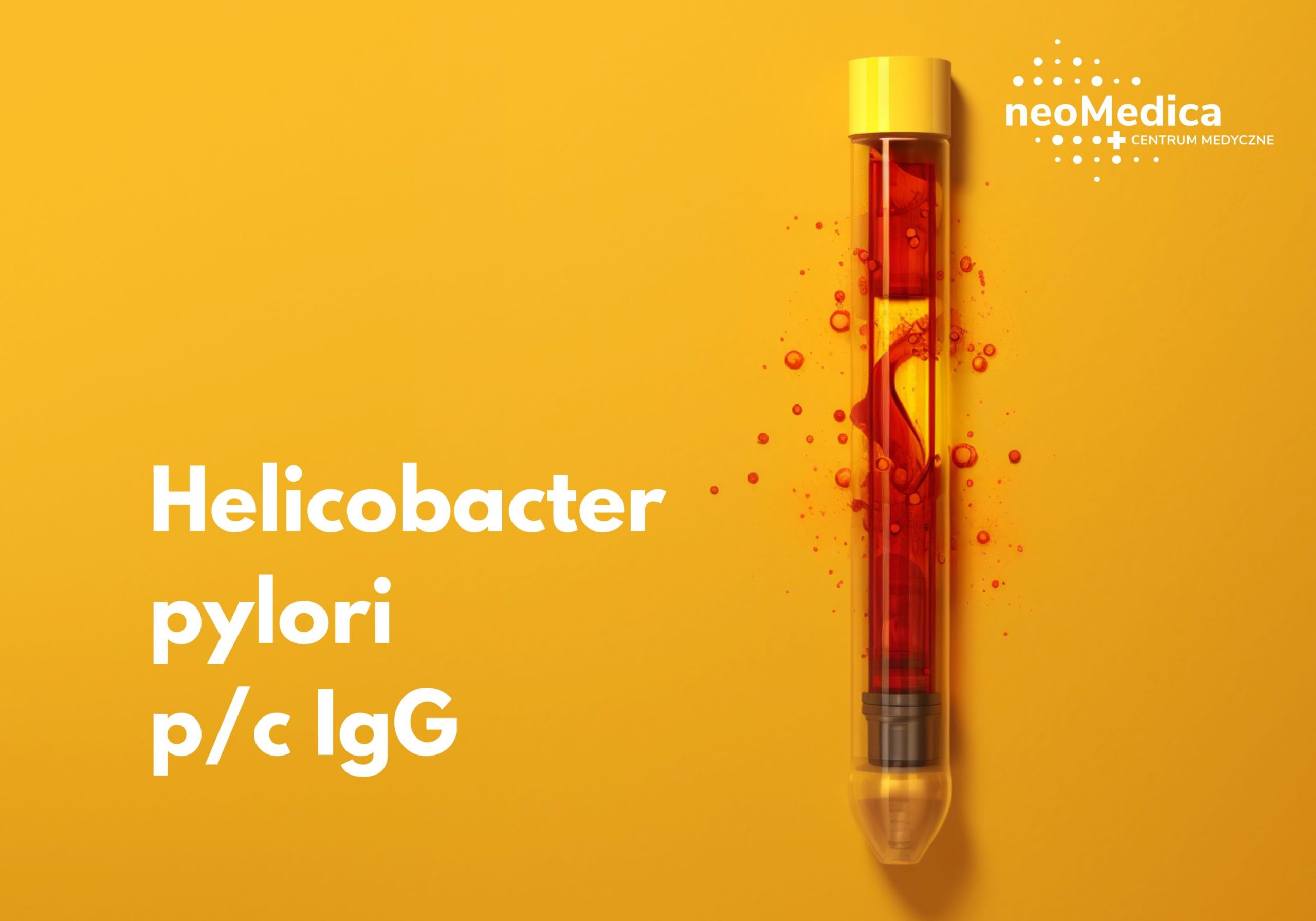 Badanie Helicobacter pylori p/c IgG Poznań | neoMedica | Kup online!