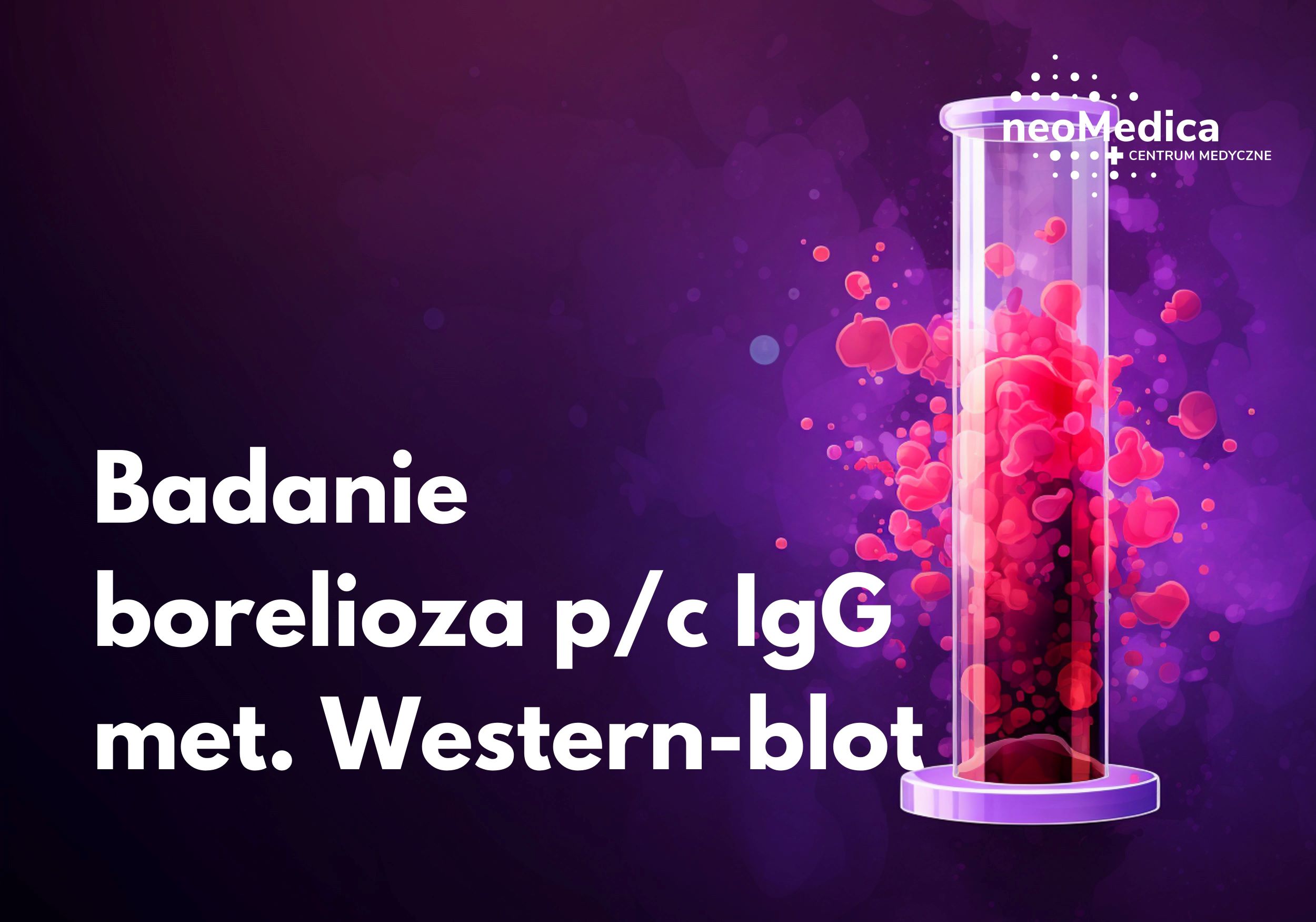 Badanie borelioza p/c IgG met. Western-blot Poznań | neoMedica