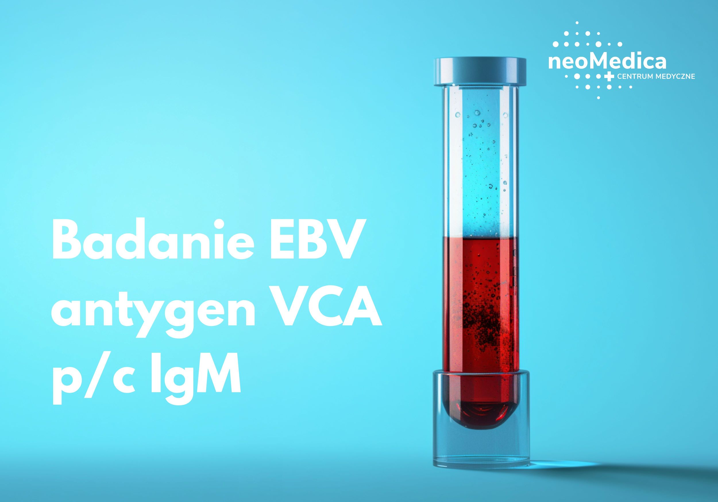Badanie EBV antygen VCA p/c IgM Poznań | neoMedica | Kup tanio online!
