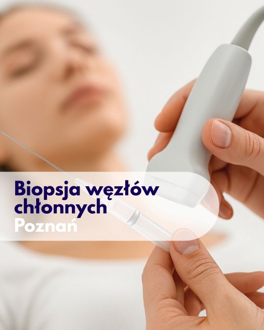 Biopsja węzłów chłonnych Poznań | neoMedica